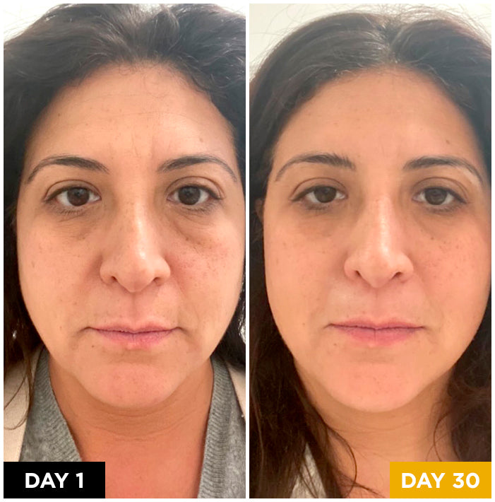 Liquid Facelift® Facial Cream#N# – RegenLabs®