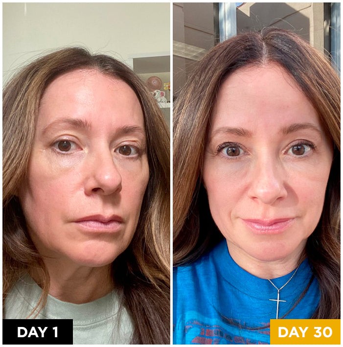 Liquid Facelift® Facial Cream#N# – RegenLabs®